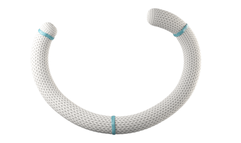 Mitral Valve Repair Rings - ACJ